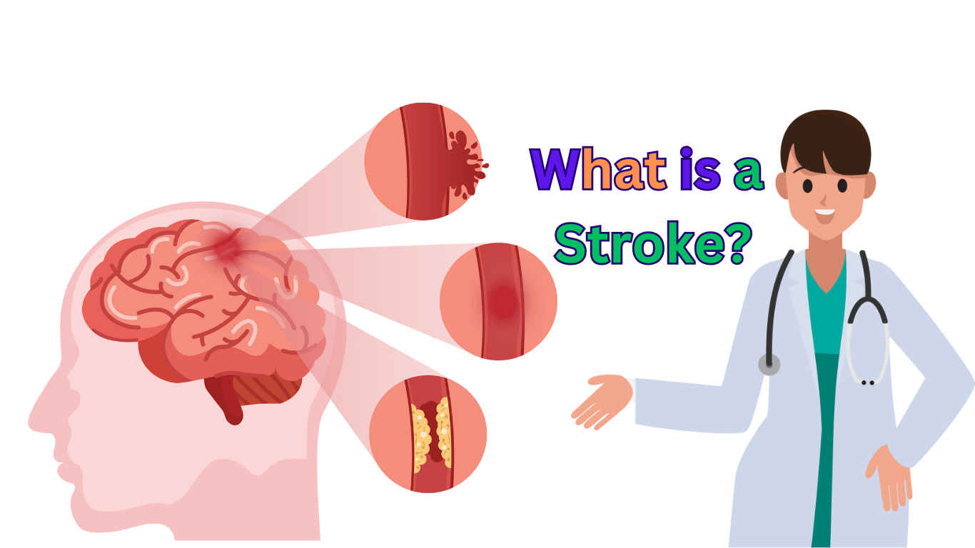 What is a Stroke? - Bizwells.com